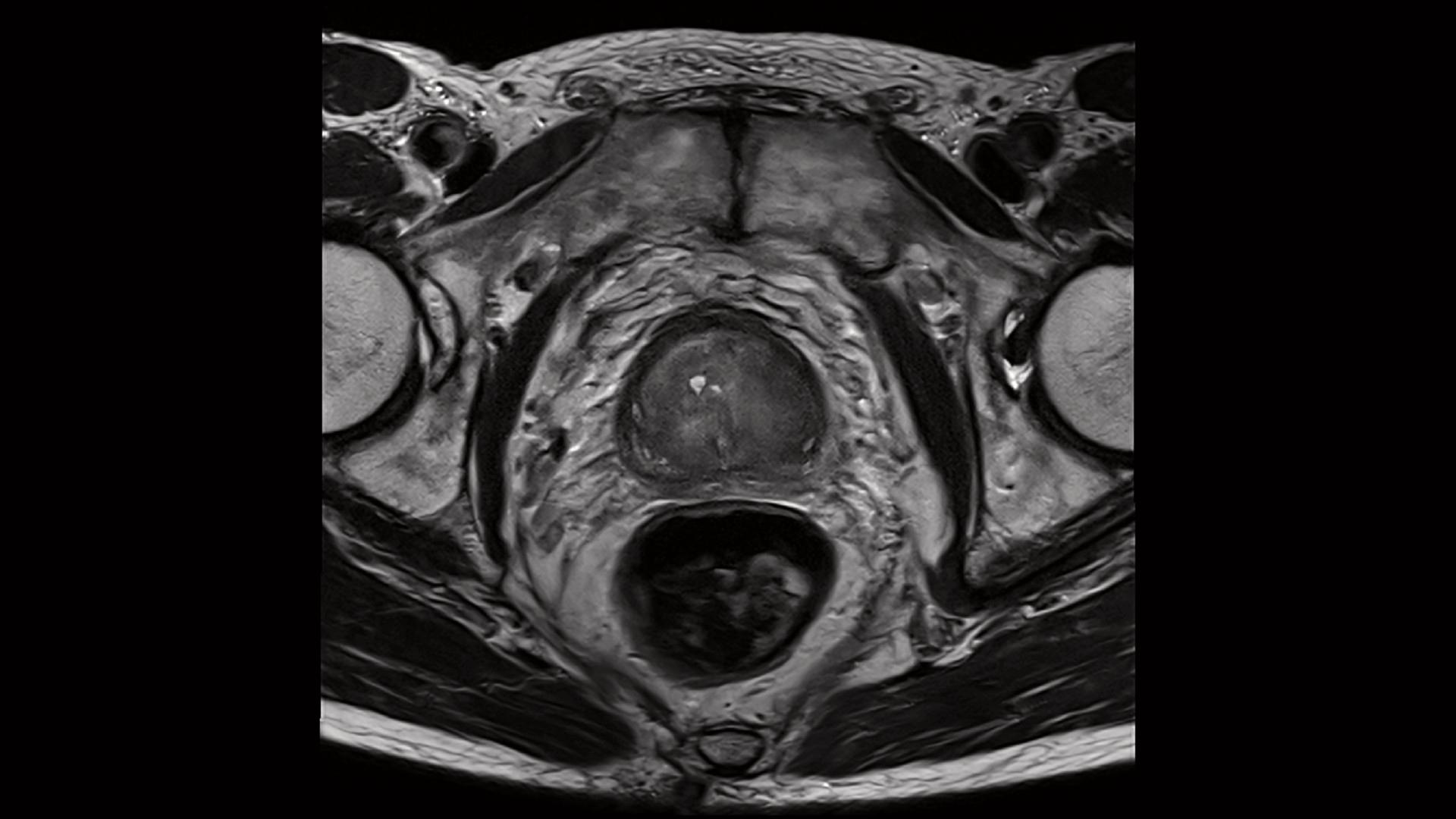 MAGNETOM Cima.X - Make the difference. - Siemens Healthineers