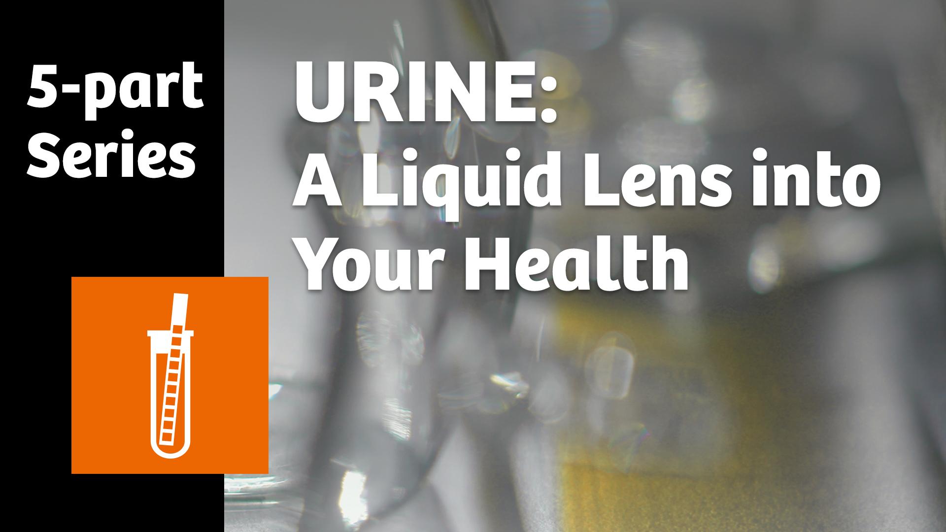 Atellica LumIQ Analyser