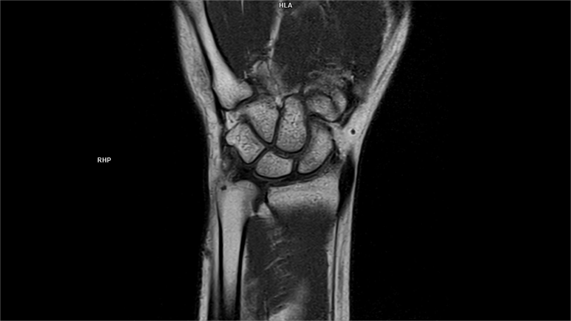 Coronal T1-MAGNETOM Free.Max - Siemens Healthineers USA