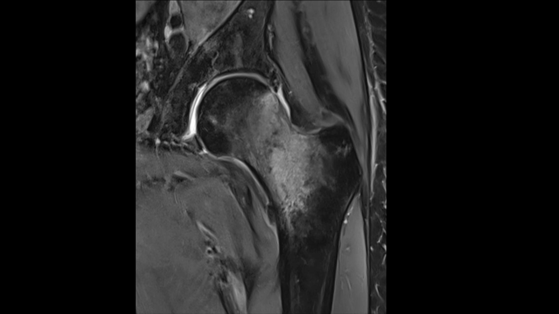 Phoenix Images for MAGNETOM Lumina 3T