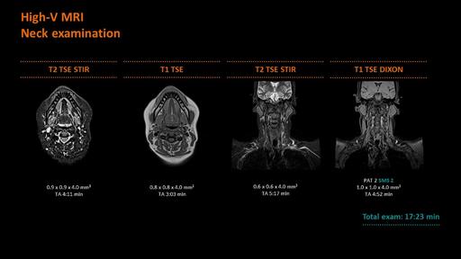 MAGNETOM Free.Max–wide bore mri - Siemens Healthineers Japan