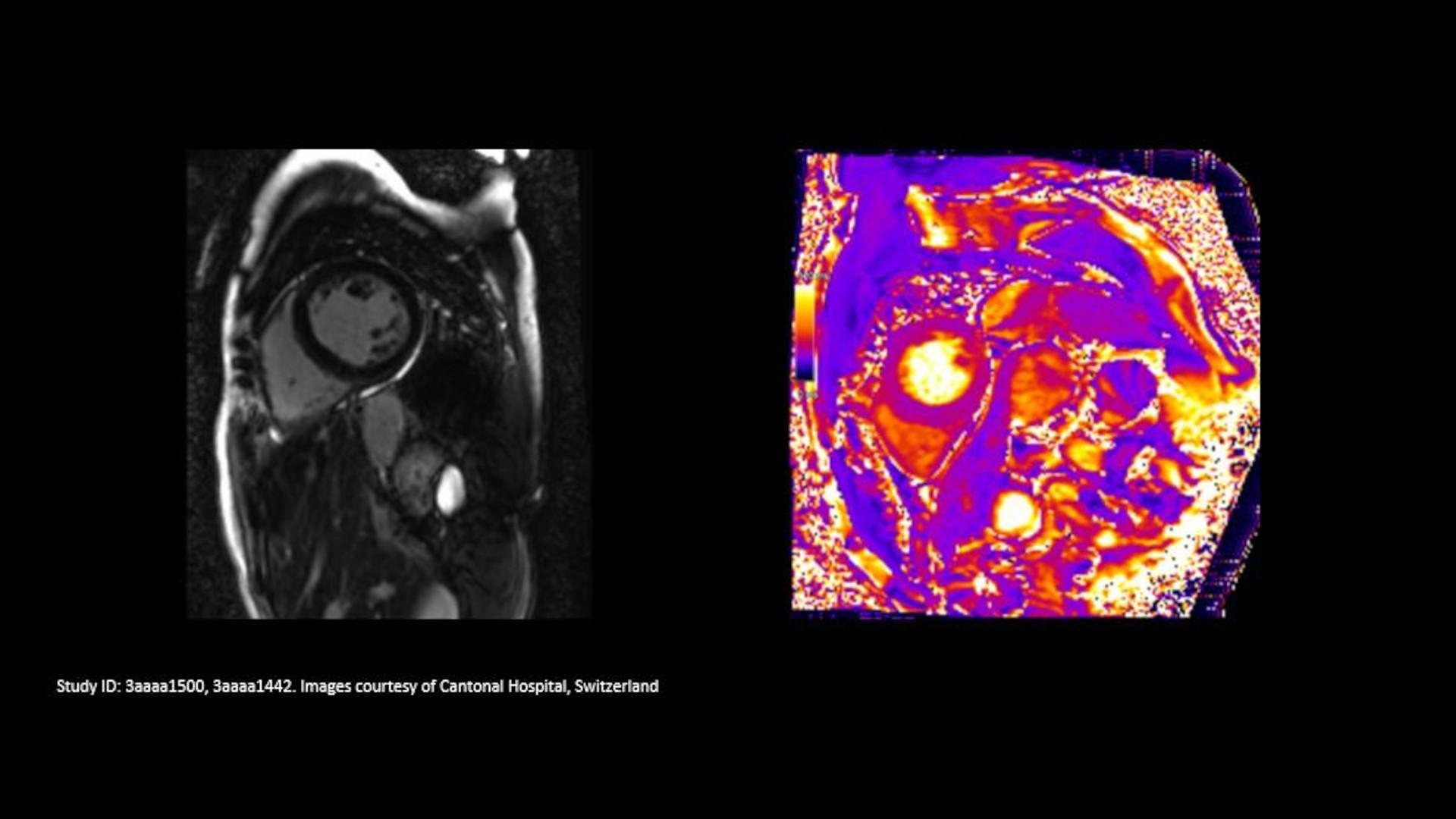 MAGNETOM Vida Fit - Siemens Healthineers