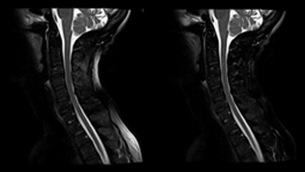 BioMatrix Technology - Siemens Healthineers