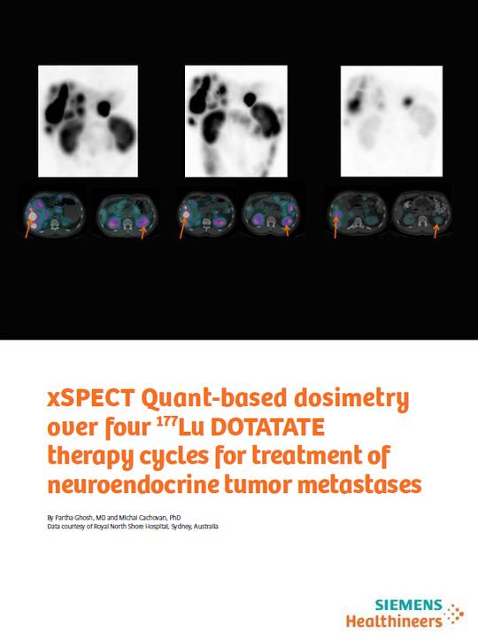 xSPECT Quant - Siemens Healthineers Latinoamérica