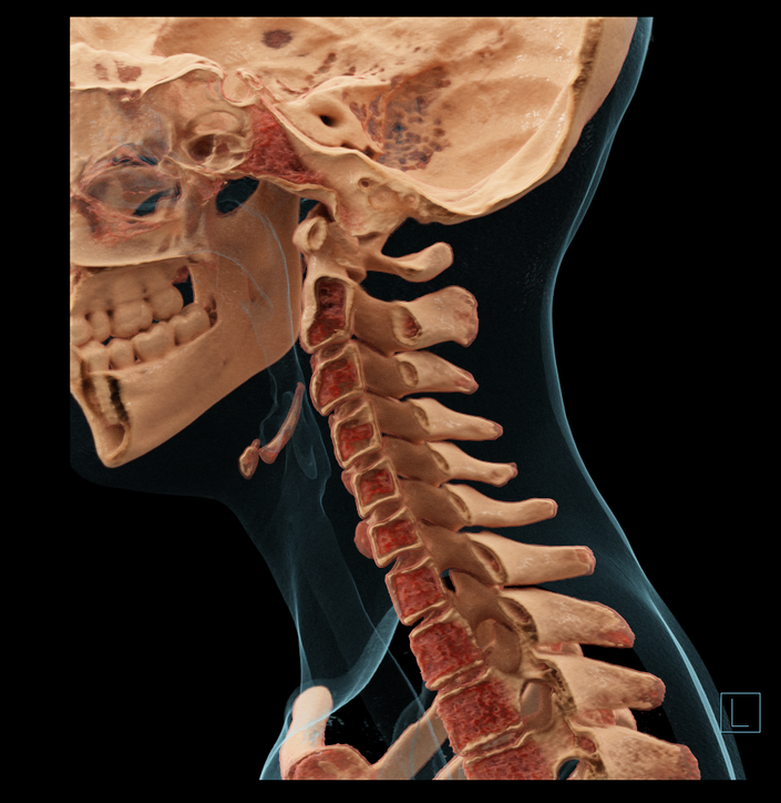 Pediatric - Computed Tomography - Siemens Healthineers USA