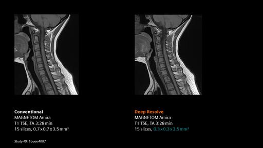 Deep Resolve - Siemens Healthineers USA