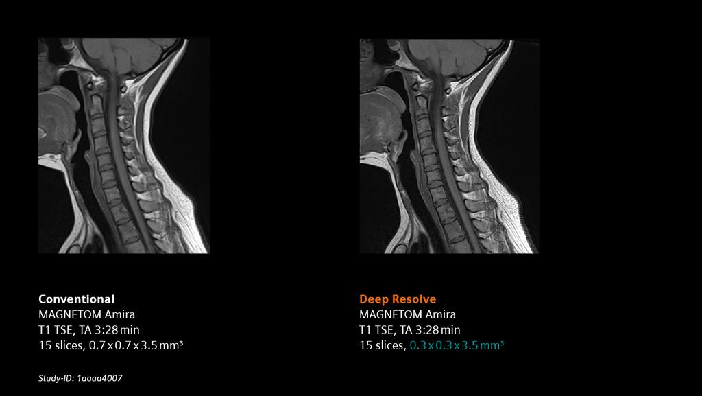 Deep Resolve - Siemens Healthineers
