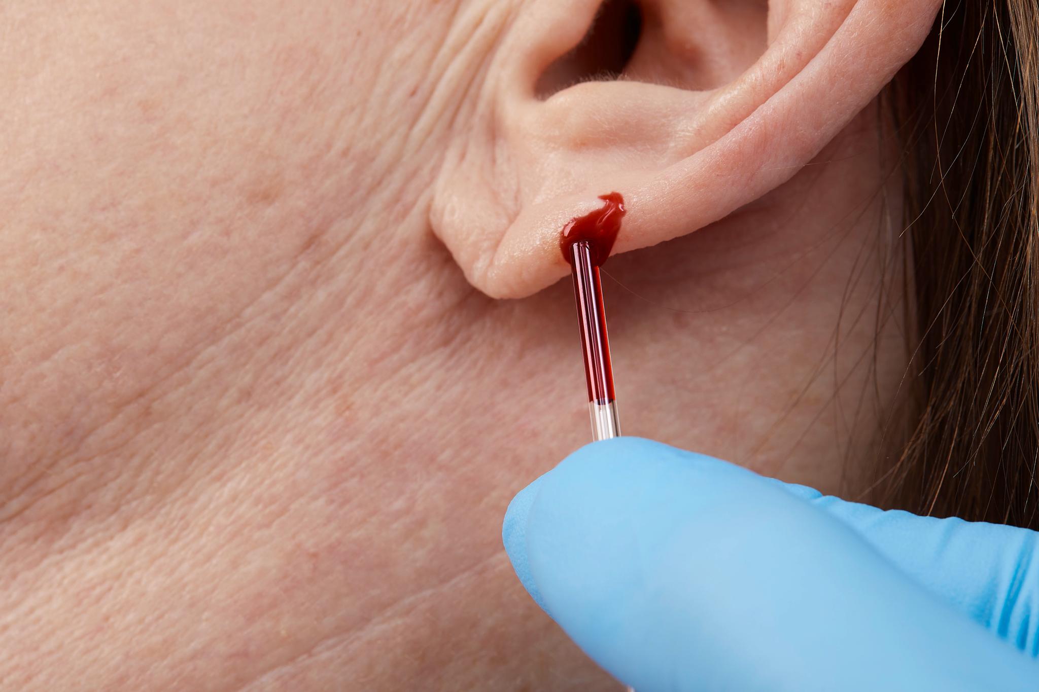 Preanalytical sampling devices