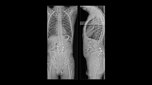 Twin Robotic X-ray scanner – Multitom Rax - Siemens Healthineers