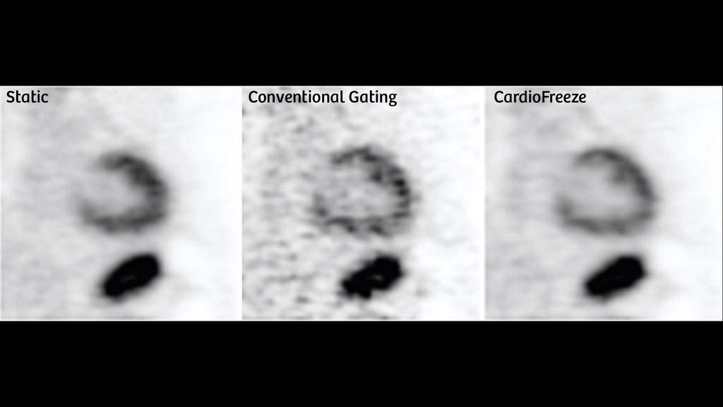 Biograph mCT PET/CT scanner - Siemens Healthineers