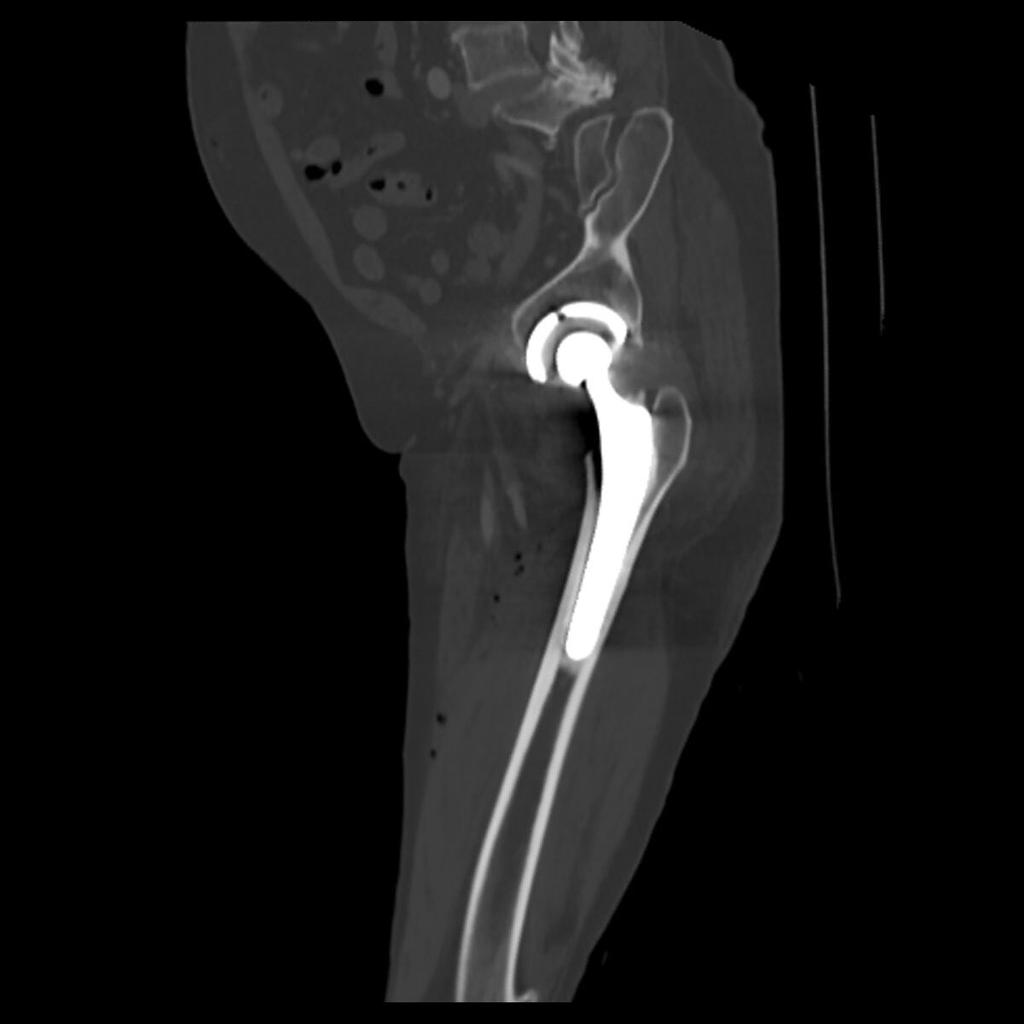 iMAR - Siemens Healthineers