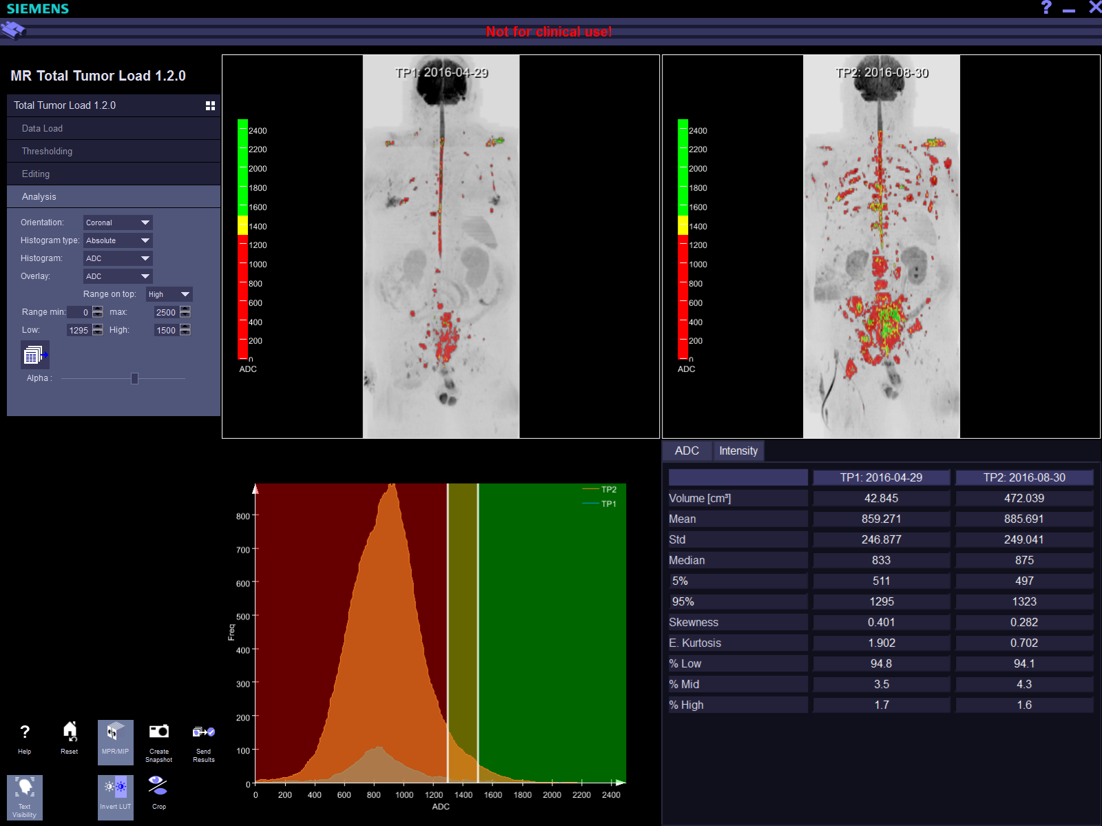 Quantitative Whole-Body MRI