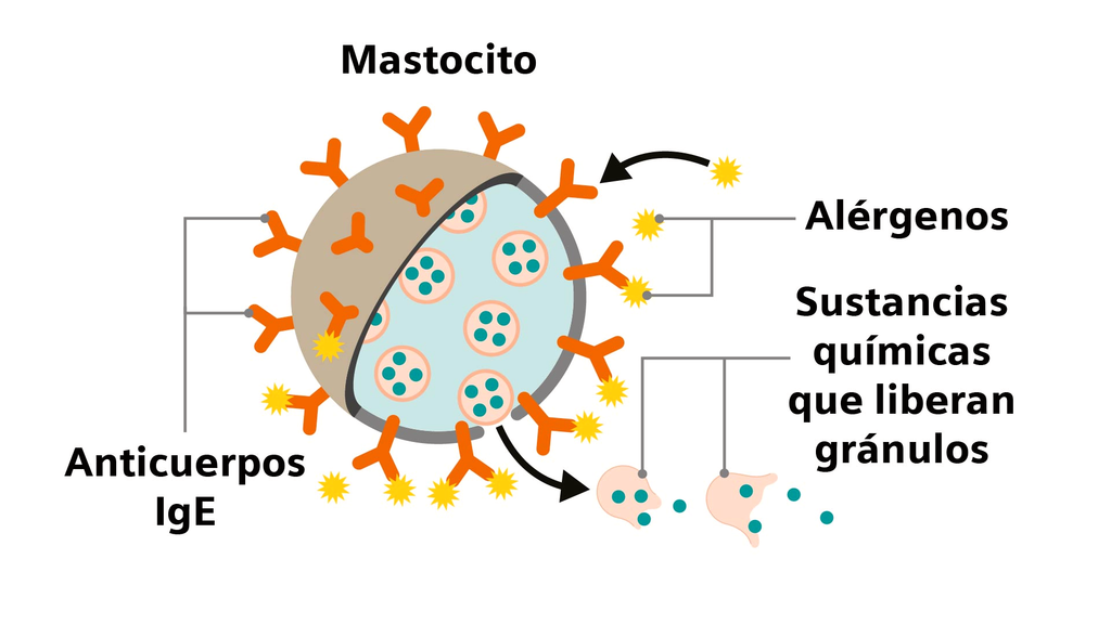 ¿Qué son las alergias? | Información para el paciente - Siemens ...
