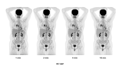 Biograph Vision PET/CT Clinical Image Gallery - Siemens Healthineers