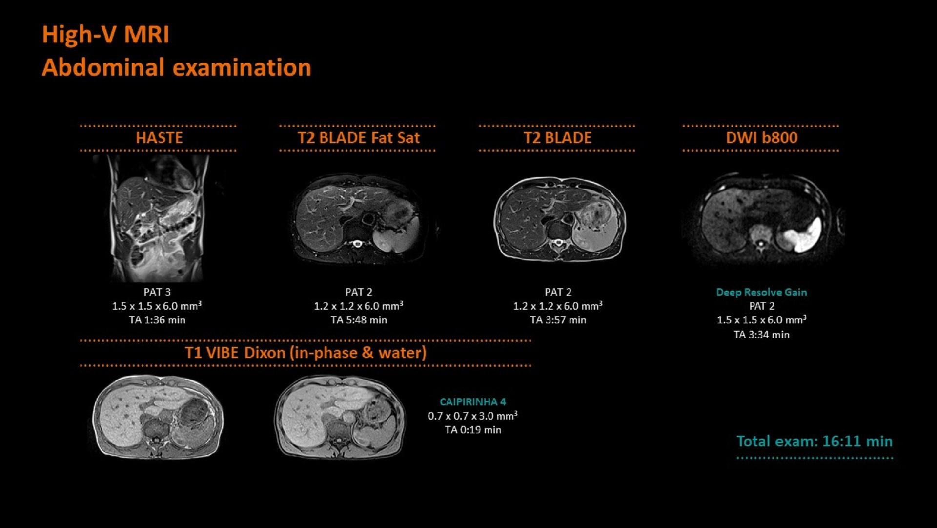 MAGNETOM Free.Star - Siemens Healthineers Japan