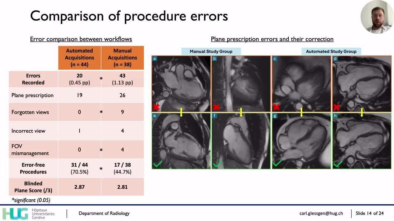 Real-life experience using a fully automated CMR planning software in a ...
