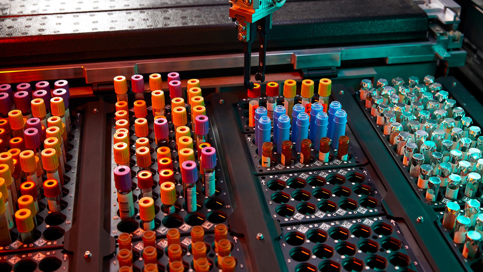 Neurofilament light chain (NfL) - Siemens Healthineers - Siemens ...