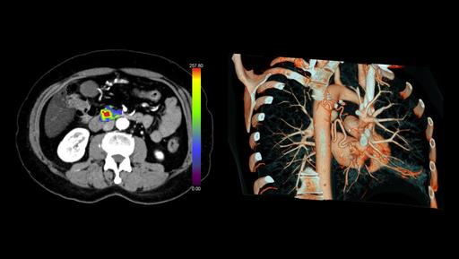 Dual Source CT in functional imaging