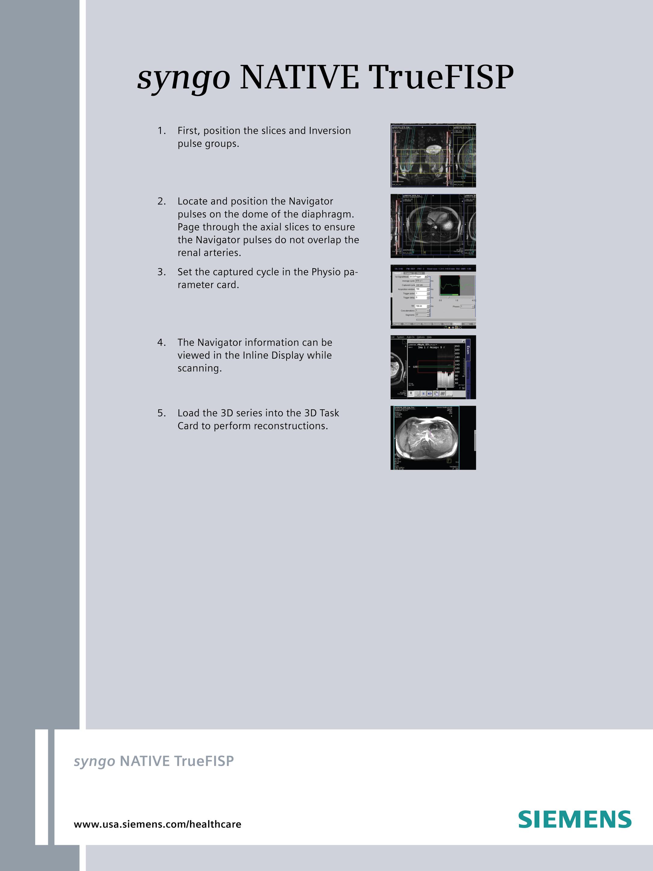 syngo NATIVE (non-contrast MR Angiography of arterles and veins): Video ...