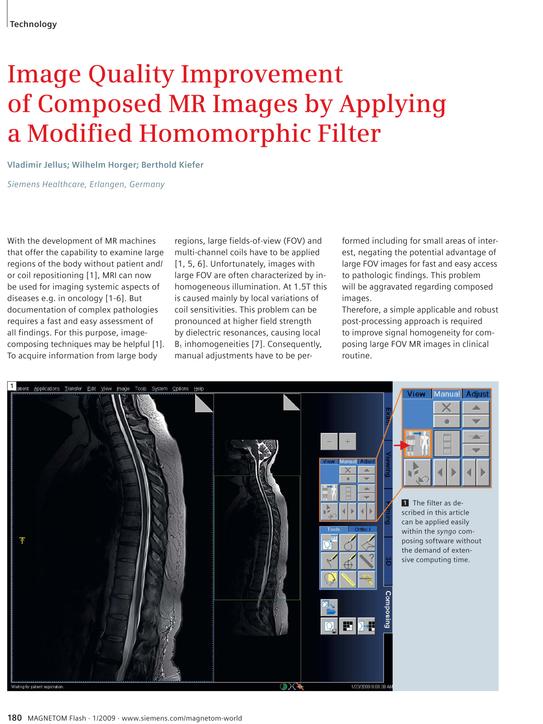 Image Quality Improvement of Composed MR Images by Applying a Modified ...