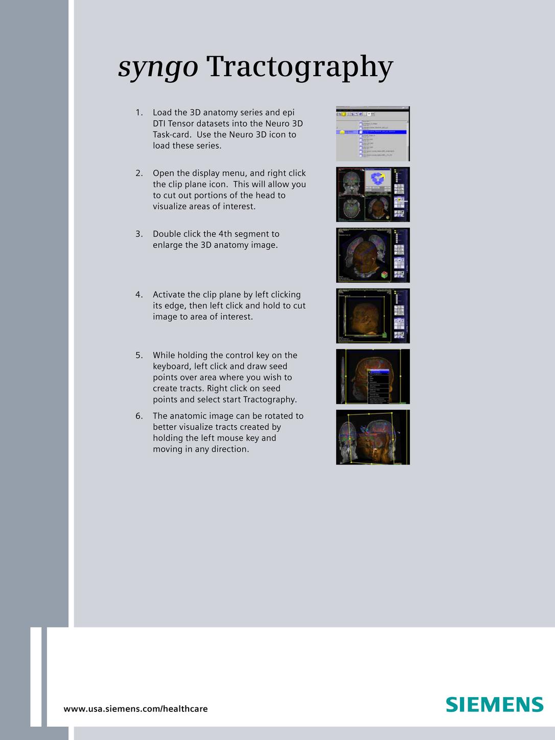 syngo DTI (Diffusion Tensor Imaging) Tractography: Video and Step-by ...