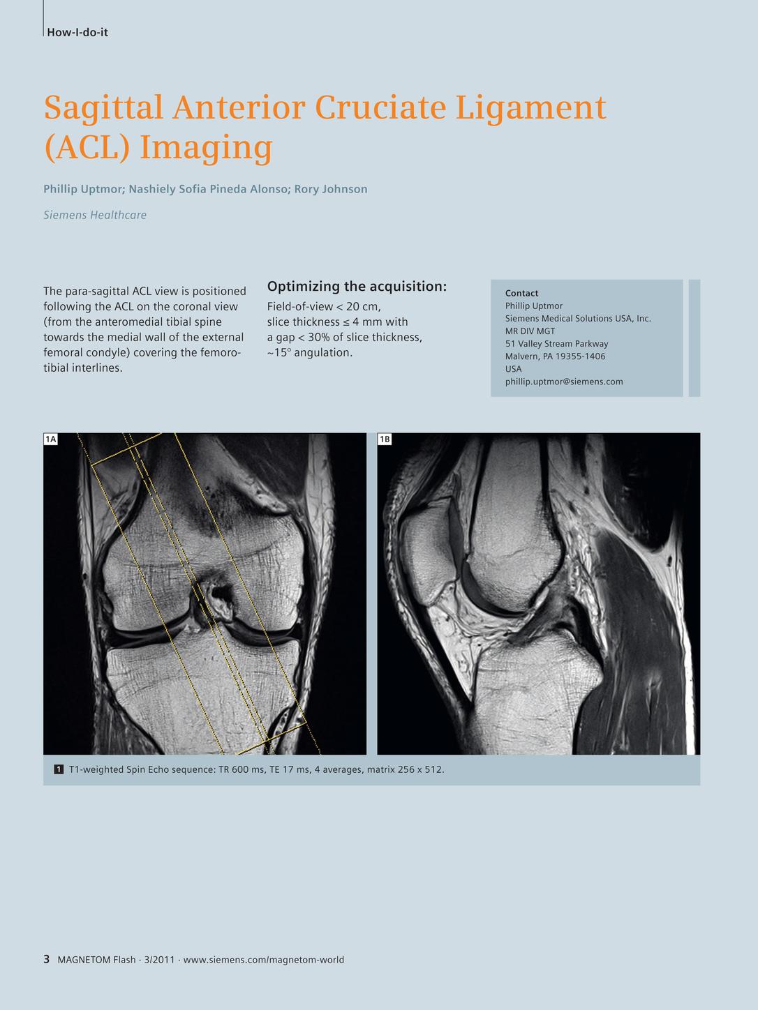 Sagittal Anterior Cruciate Ligament (ACL) Imaging
