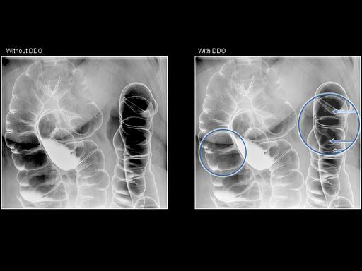 Siemens Healthcare – The new Luminos dRF Siemens Healthineers Italia