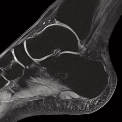 Extremity Matrix Coil (MAGNETOM ESSENZA) - Siemens Healthineers