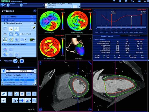 CT Cardio-Vascular Engine Siemens Healthineers Italia
