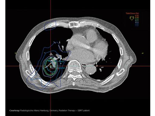 Multiple-X ONCOR K-Class - Siemens Healthineers