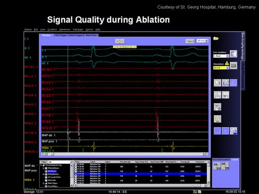 Hemodynamic Recording - Siemens Healthineers España