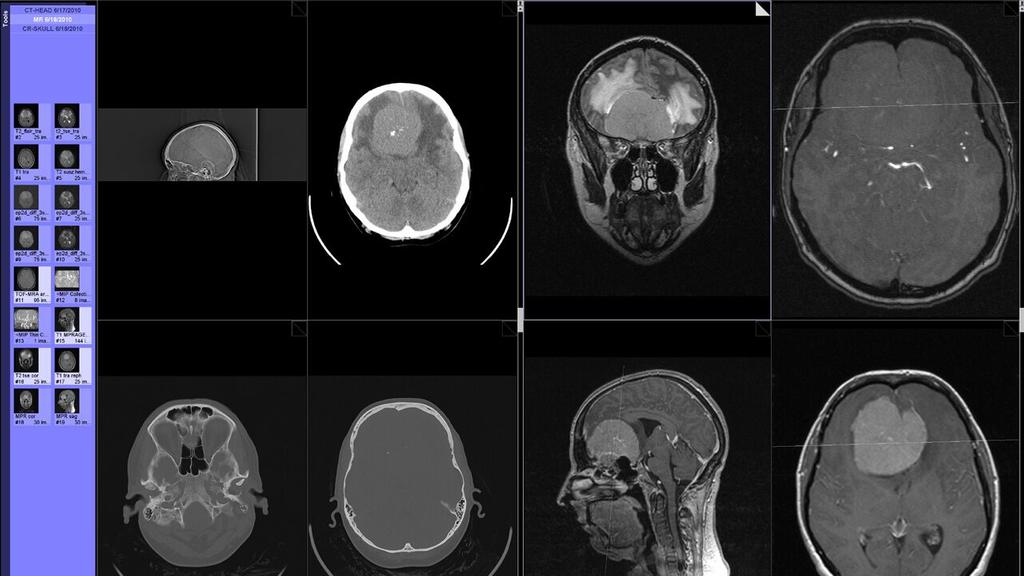 syngo Imaging - Siemens Healthineers Suisse