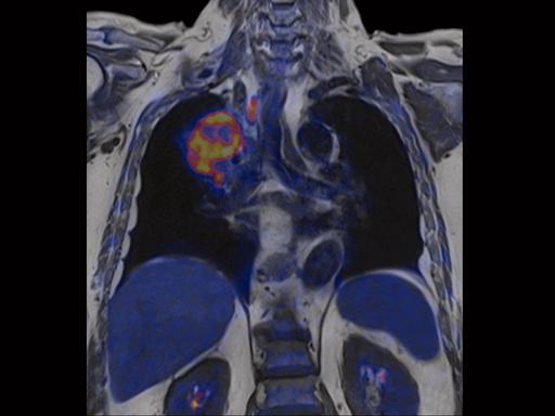 Biograph mMR - Siemens Healthineers USA