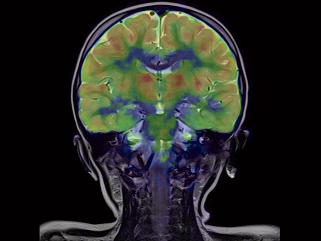 Biograph mMR - Siemens Healthineers USA