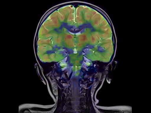 Biograph mMR - Siemens Healthineers USA