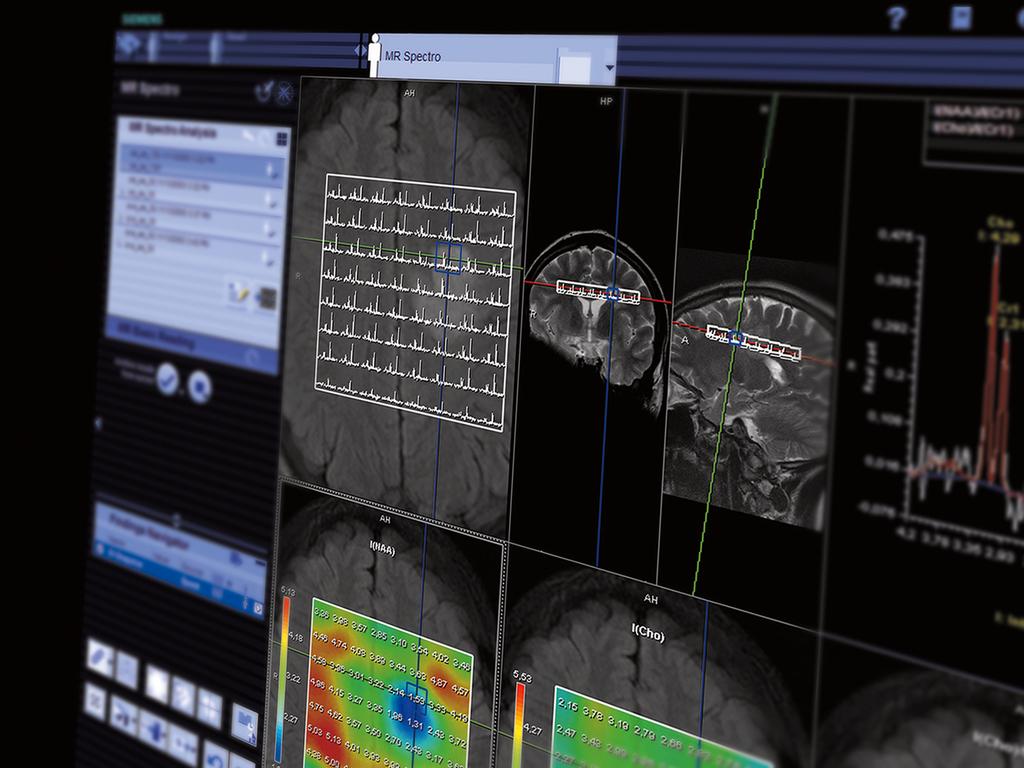 syngo.via - Siemens Healthineers USA