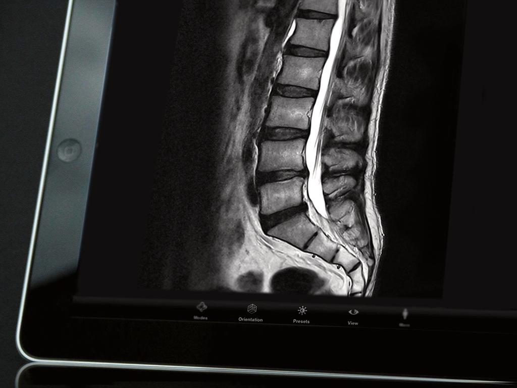 syngo.via - Siemens Healthineers USA