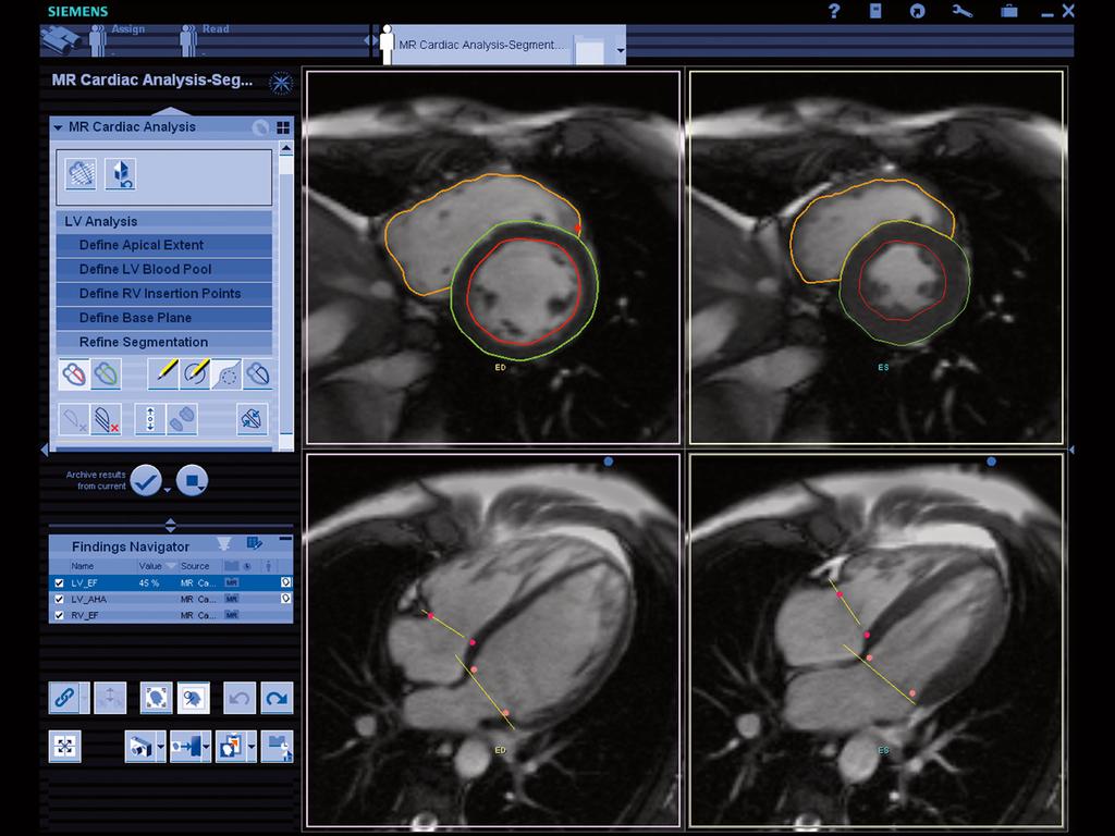 syngo.via - Siemens Healthineers USA