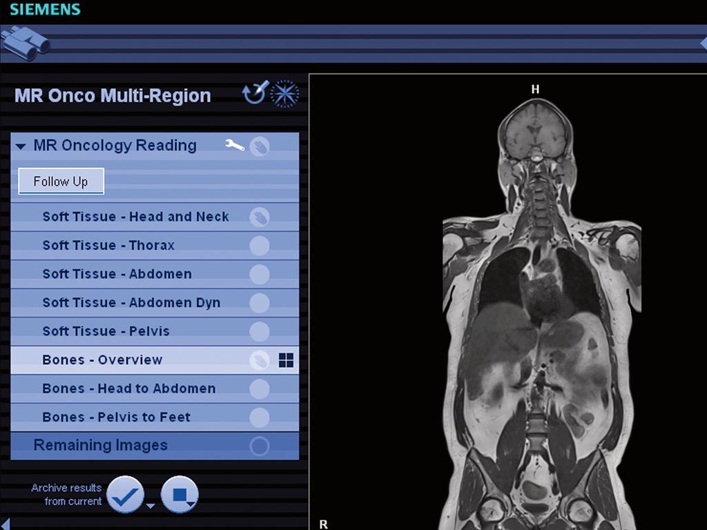 syngo.via - Siemens Healthineers USA