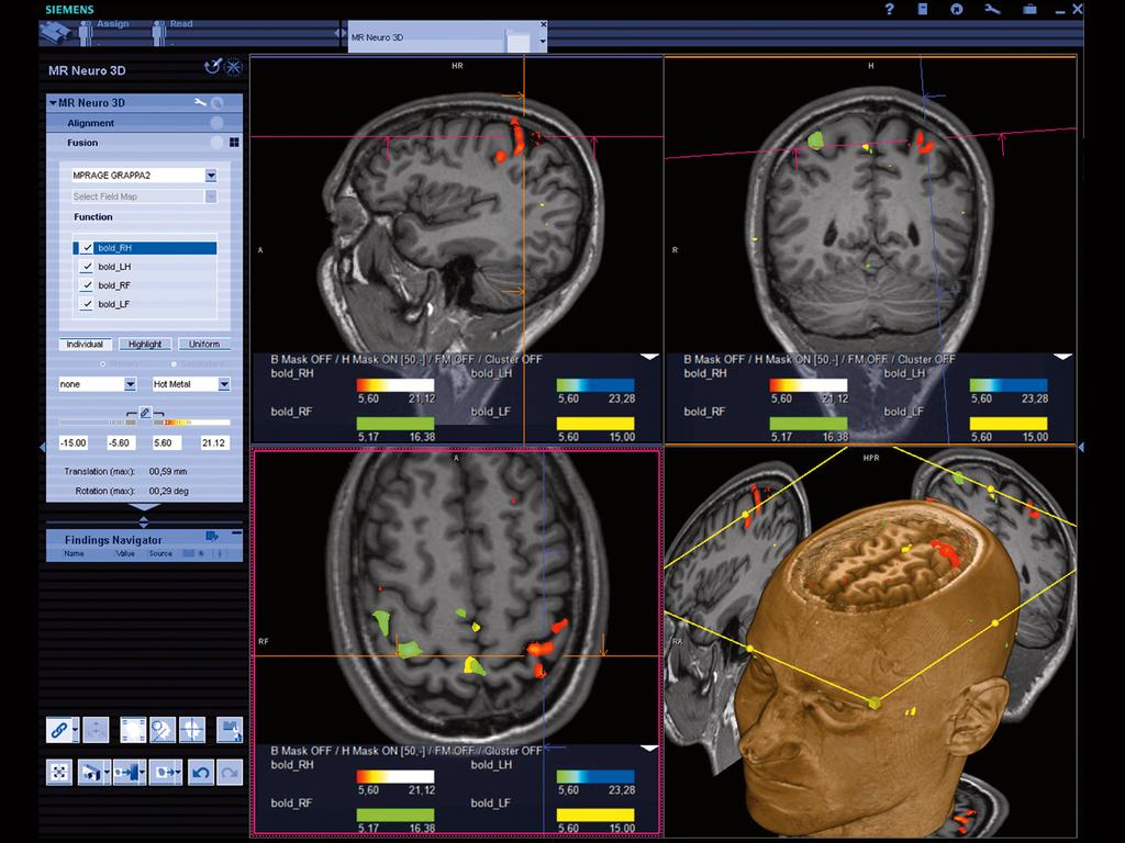 syngo.via - Siemens Healthineers USA