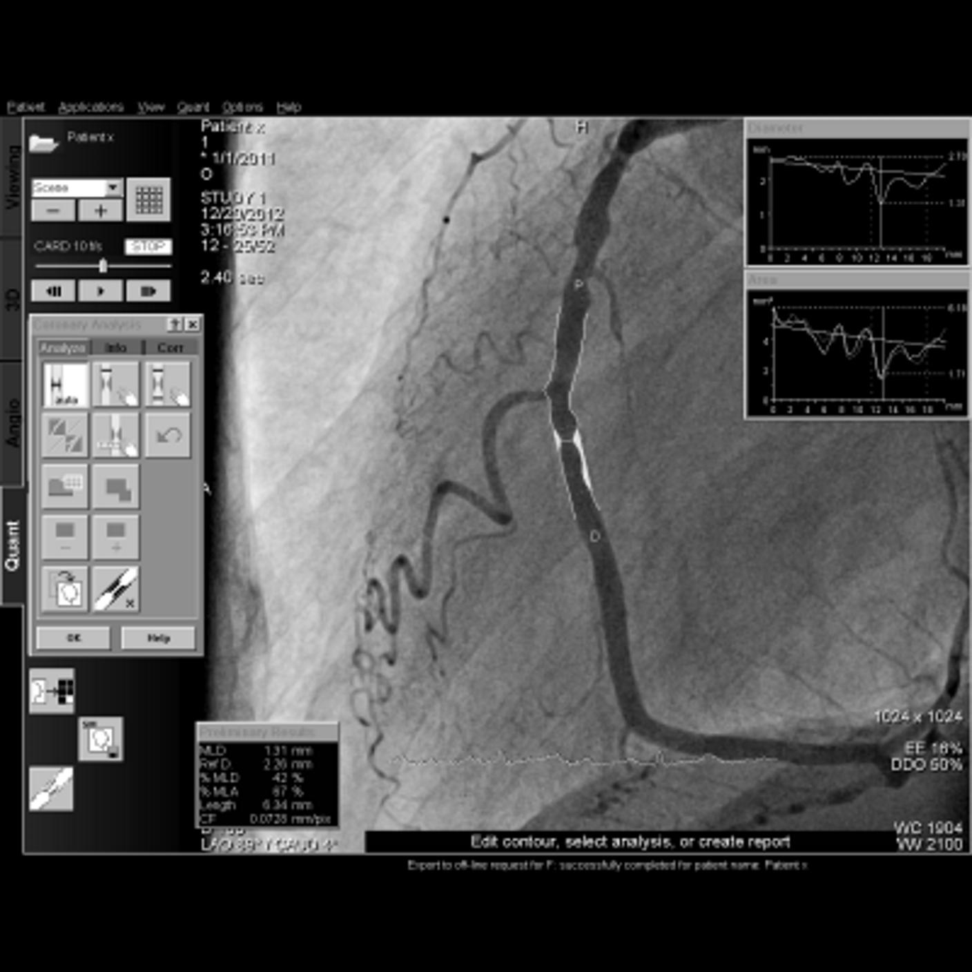 Scientific QCA Analysis