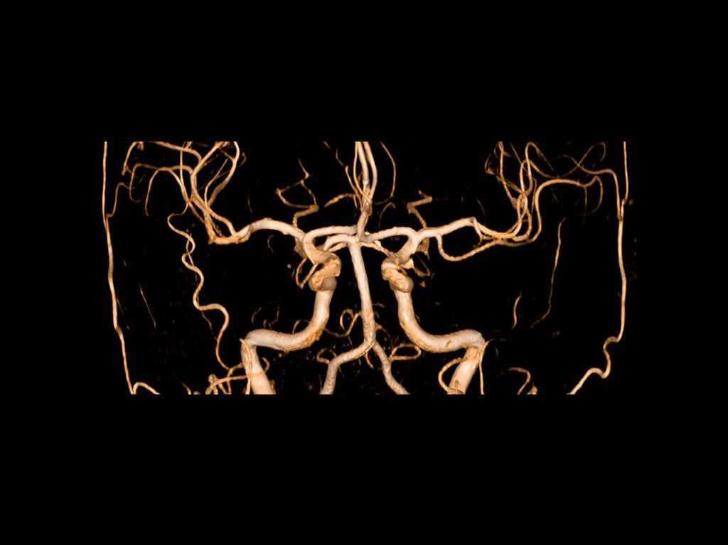 MAGNETOM Spectra - Siemens Healthineers Italia