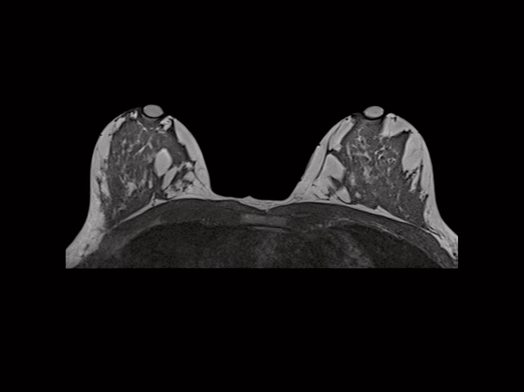 MAGNETOM Spectra - Siemens Healthineers Italia