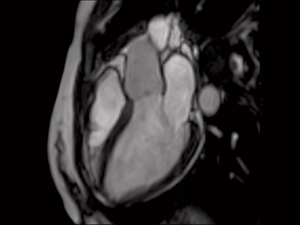 MAGNETOM Spectra - Siemens Healthineers Italia