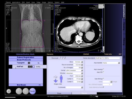 SOMATOM Spirit Siemens Healthineers Italia