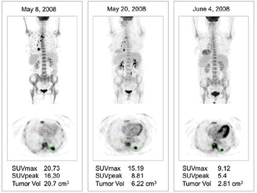 syngo.via - Siemens Healthineers USA