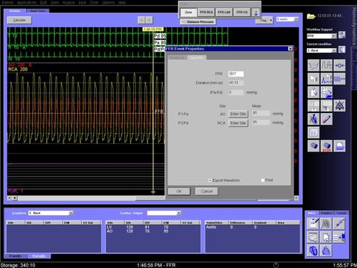 AXIOM Sensis XP & Sensis XP Lite 지멘스 헬시니어스㈜
