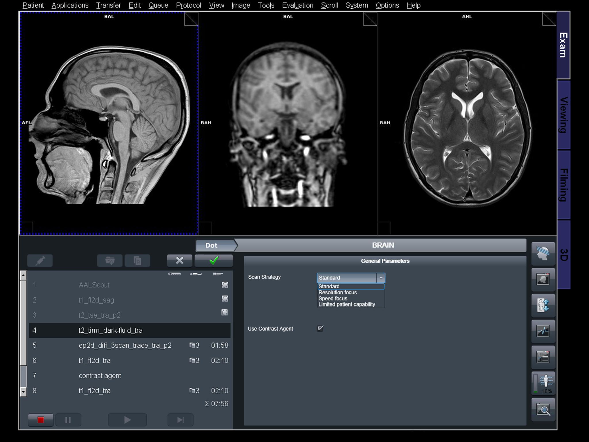 GOBrain - Siemens Healthineers USA