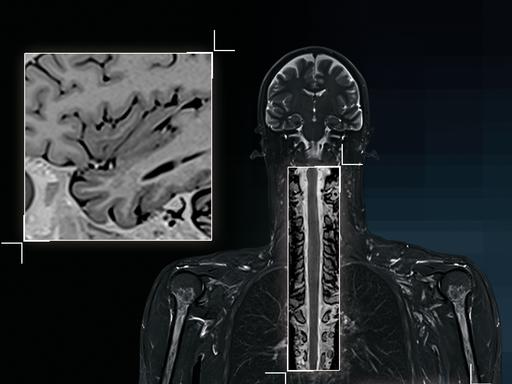 MAGNETOM Prisma - MRI Scanner - Siemens Healthineers Vietnam