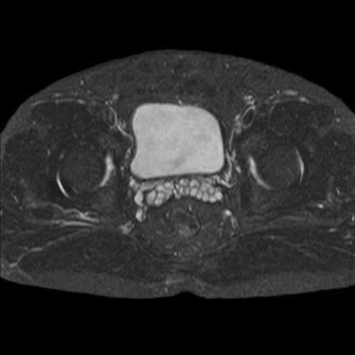 MAGNETOM C! - Pelvis male